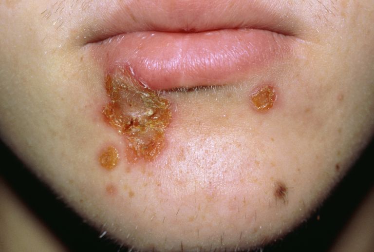 Tips For Identifying Common Skin Rashes